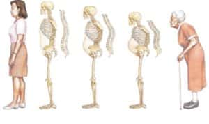 德國膠原-Landing – DotDot 德國膠原 l 香港官方網店